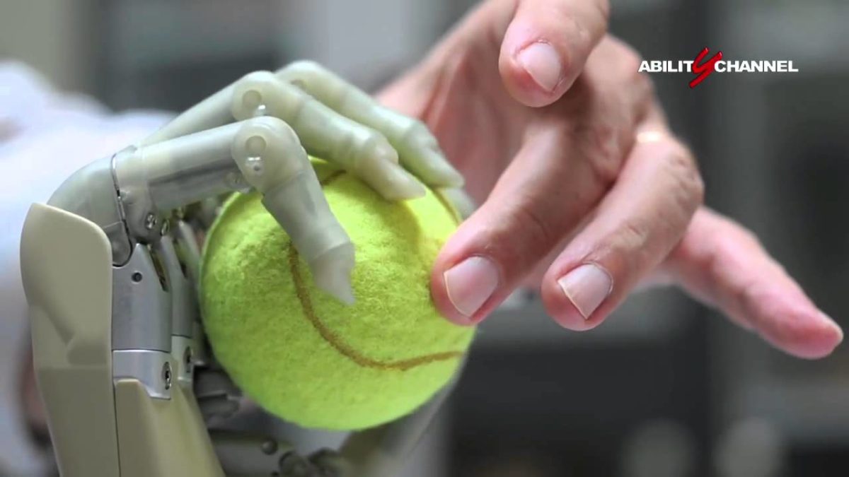 Centro protesi INAIL di Budrio, gli arti superiori mioelettrici