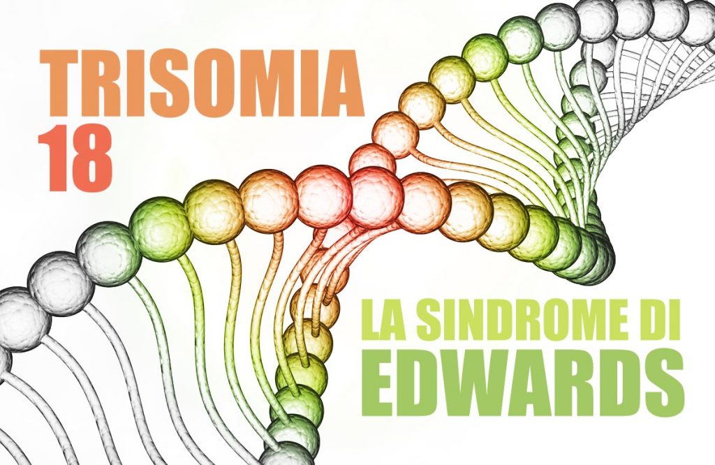 Trisomia 18, cos'è la Sindrome di Edwards | Ability Channel