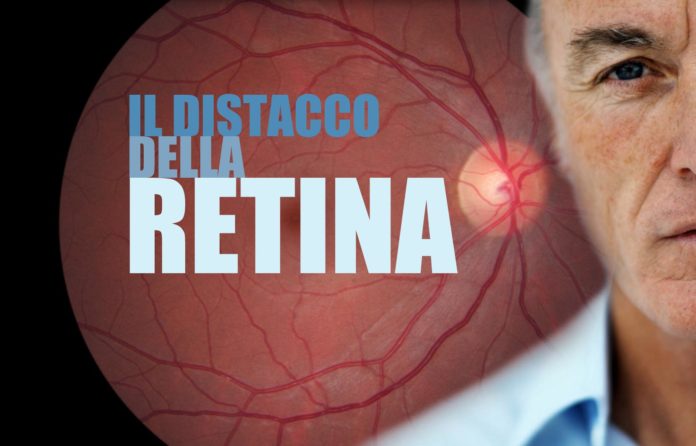 Distacco di retina sintomi, diagnosi e terapia
