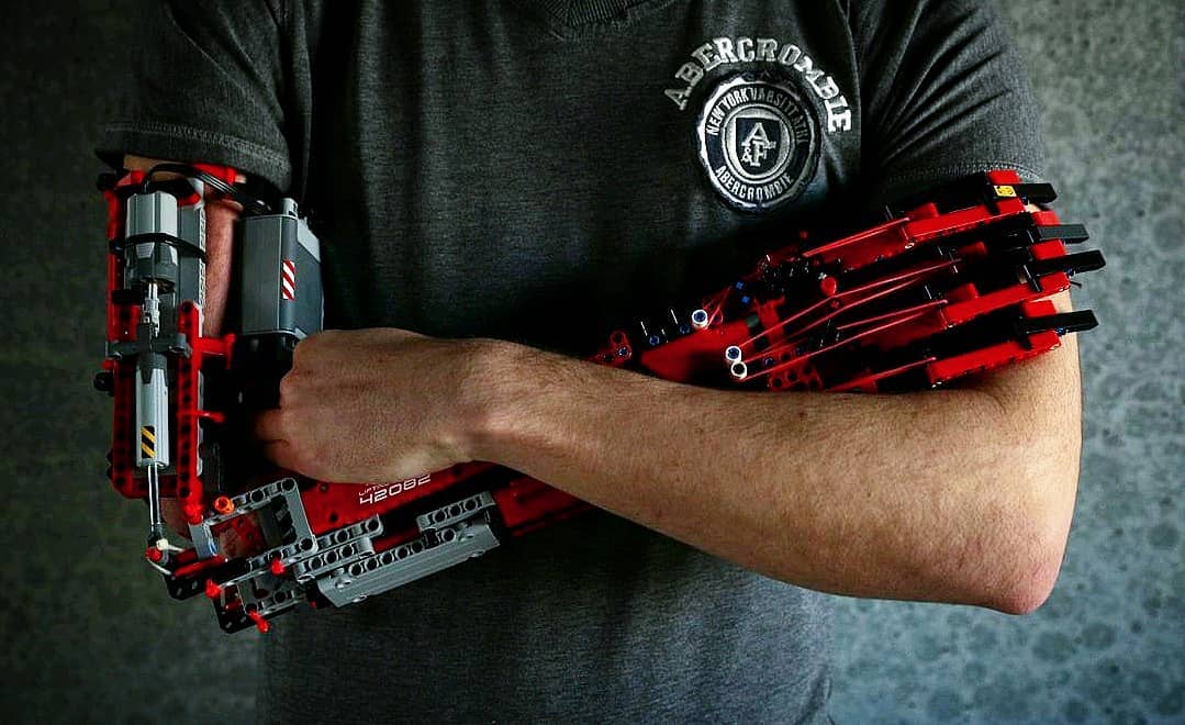 Hand Solo, un ragazzo col braccio Lego: ecco come funziona