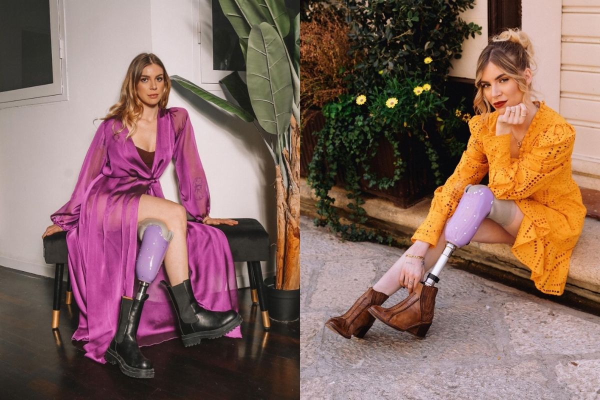 Nina Sophie Rima, chi è l'influencer amputata: la storia