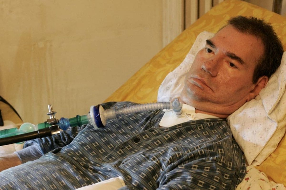 Chi era Piergiorgio Welby? Storia di un caso di Eutanasia in Italia