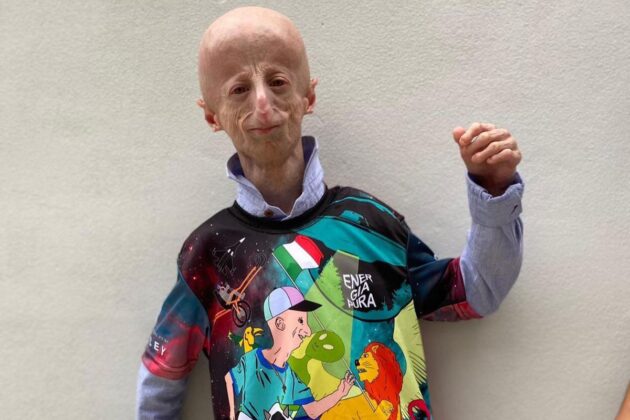 Chi era Sammy Basso: lauree, lavoro, progeria e la morte improvvisa